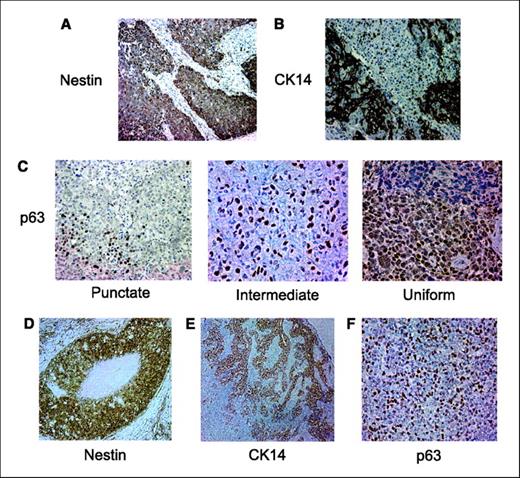 Nestin Is Expressed in the Basal/Myoepithelial Layer of the Mammary ...