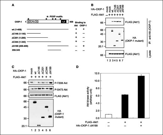 Casein Kinase 2–Interacting Protein-1, a Novel Akt Pleckstrin Homology ...