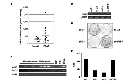 γ-Aminobutyric Acid (GABA) Stimulates Pancreatic Cancer Growth through ...