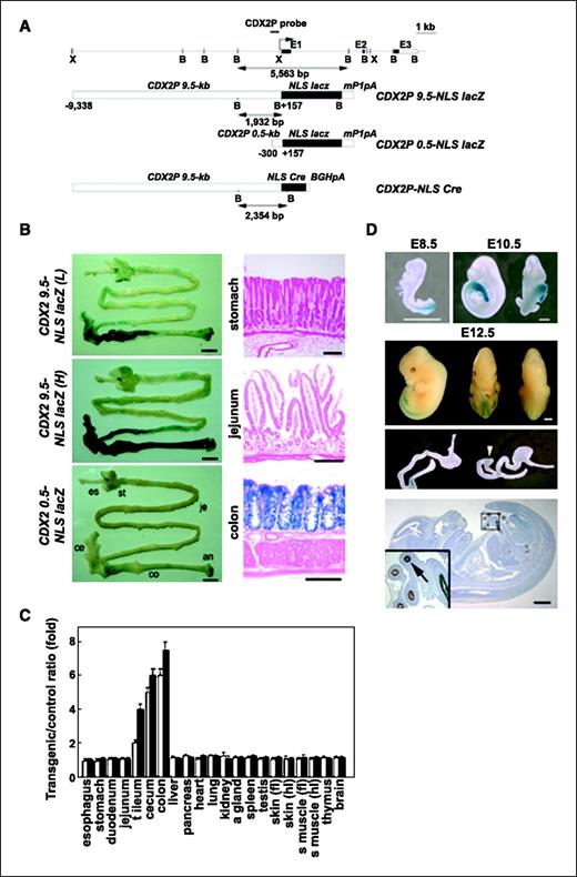 Mouse Model of Colonic Adenoma-Carcinoma Progression Based on Somatic ...