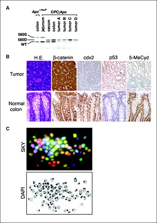 Mouse Model of Colonic Adenoma-Carcinoma Progression Based on Somatic ...