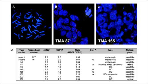The Collagen Receptor Endo180 (CD280) Is Expressed on Basal-like Breast ...