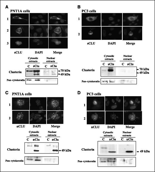 Clusterin Isoforms Differentially Affect Growth and Motility of ...