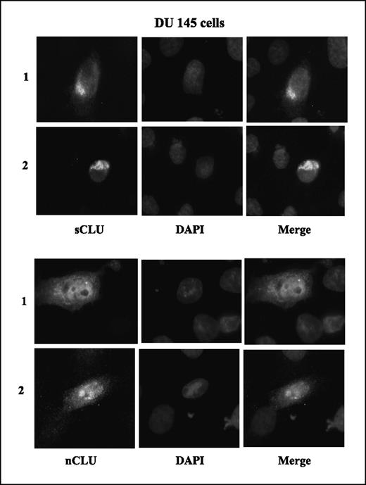 Clusterin Isoforms Differentially Affect Growth and Motility of ...