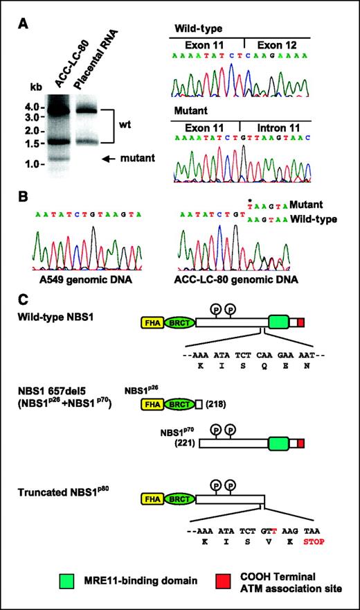 Novel NBS1 Heterozygous Germ Line Mutation Causing MRE11-Binding Domain ...