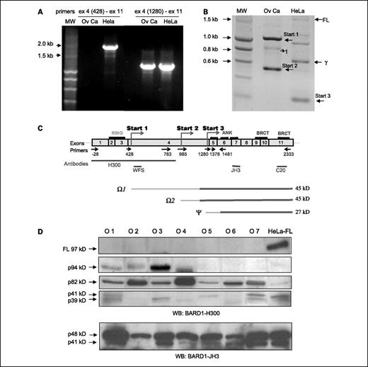 Oncogenic BARD1 Isoforms Expressed in Gynecological Cancers | Cancer ...