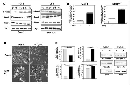 Sp1 Is Required for Transforming Growth Factor-β–Induced Mesenchymal ...
