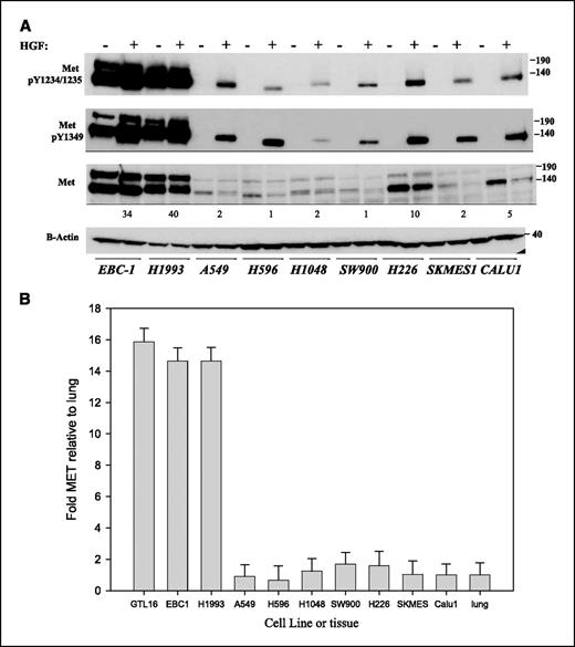 Lung Cancer Cell Lines Harboring MET Gene Amplification Are Dependent ...