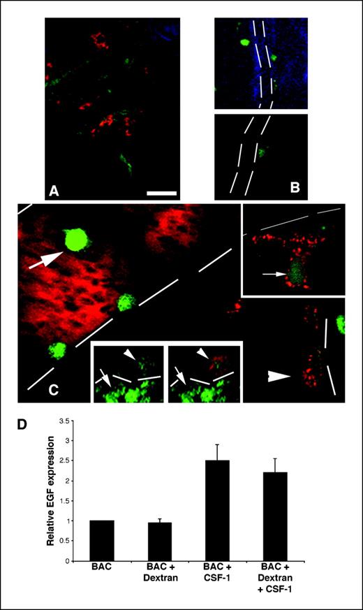 Direct Visualization of Macrophage-Assisted Tumor Cell Intravasation in ...