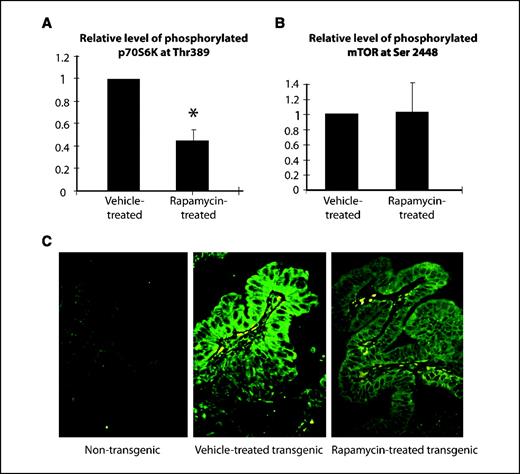 Therapeutic Effect of Rapamycin on Gallbladder Cancer in a Transgenic ...