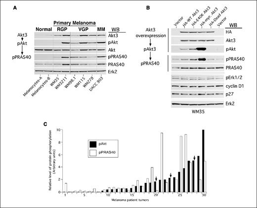 PRAS40 Deregulates Apoptosis in Malignant Melanoma | Cancer Research ...