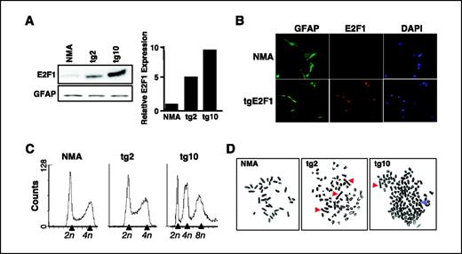 Transgenic E2F1 Expression in the Mouse Brain Induces a Human-Like ...