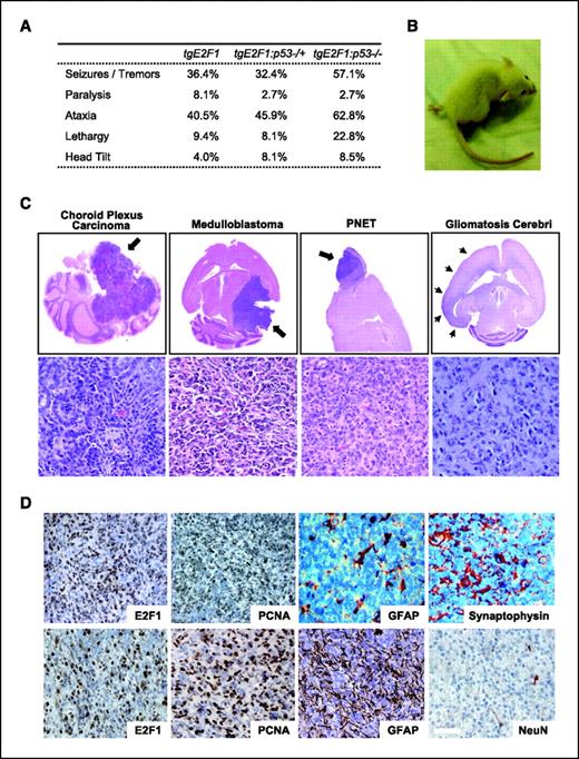 Transgenic E2F1 Expression in the Mouse Brain Induces a Human-Like ...