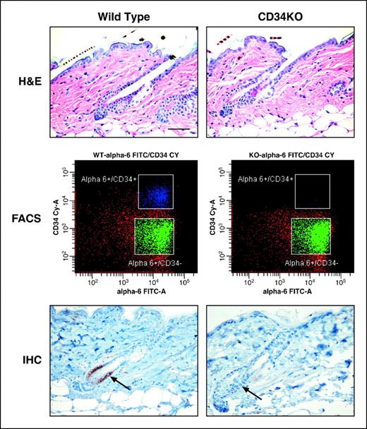 CD34 Expression by Hair Follicle Stem Cells Is Required for Skin Tumor ...