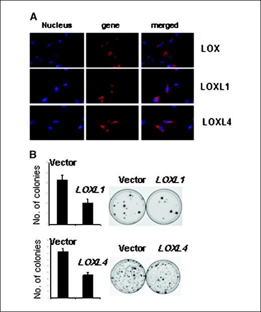 LOXL1 and LOXL4 Are Epigenetically Silenced and Can Inhibit Ras ...