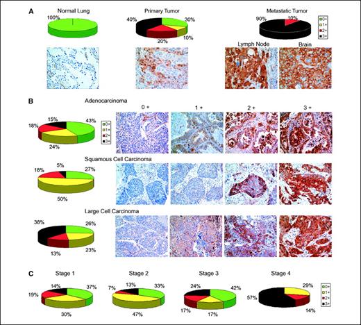 Paxillin Is a Target for Somatic Mutations in Lung Cancer: Implications ...