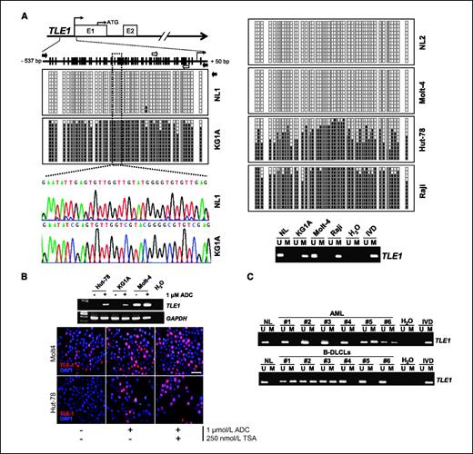 Epigenetic Inactivation of the Groucho Homologue Gene TLE1 in ...