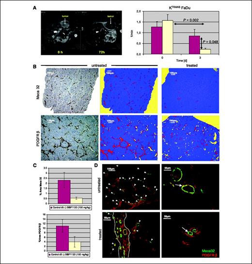 BIBF 1120: Triple Angiokinase Inhibitor with Sustained Receptor ...