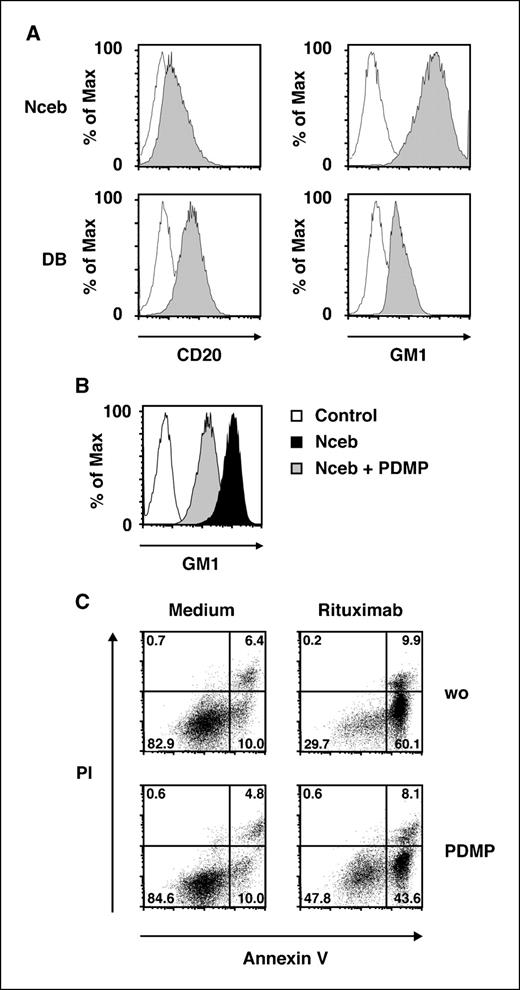 GM1 Expression of Non-Hodgkin's Lymphoma Determines Susceptibility to ...