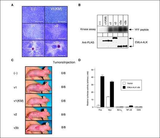 Identification of Novel Isoforms of the EML4-ALK Transforming Gene in ...