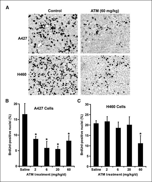 Atypical Protein Kinase Cι Expression and Aurothiomalate Sensitivity in ...