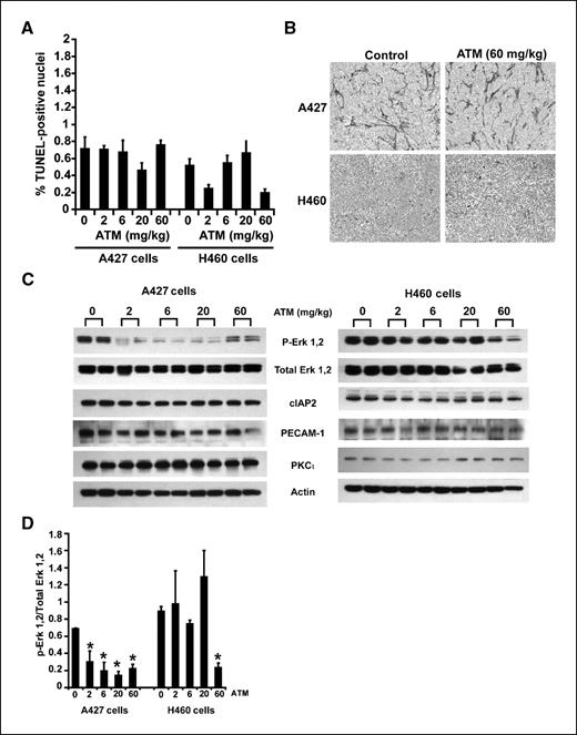Atypical Protein Kinase Cι Expression and Aurothiomalate Sensitivity in ...