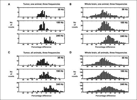 New Insights into Tumor Microstructure Using Temporal Diffusion ...