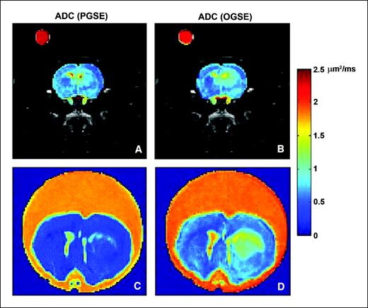 New Insights into Tumor Microstructure Using Temporal Diffusion ...