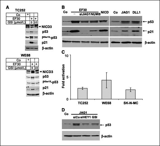 EWS-FLI1 Suppresses NOTCH-Activated p53 in Ewing's Sarcoma | Cancer ...