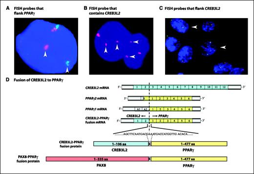 CREB3L2-PPARγ Fusion Mutation Identifies a Thyroid Signaling Pathway ...