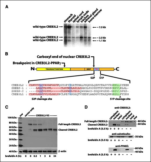 CREB3L2-PPARγ Fusion Mutation Identifies a Thyroid Signaling Pathway ...