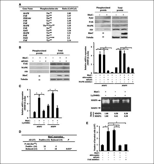 RhoC Promotes Metastasis via Activation of the Pyk2 Pathway in Prostate ...