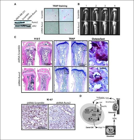 Runx2 Transcriptional Activation of Indian Hedgehog and a Downstream ...