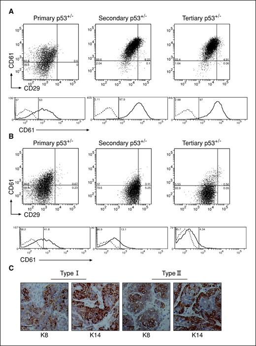 The Mammary Progenitor Marker CD61/β3 Integrin Identifies Cancer Stem ...