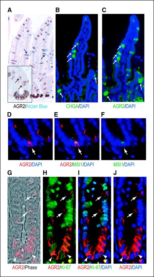 The Adenocarcinoma-Associated Antigen, AGR2, Promotes Tumor Growth ...
