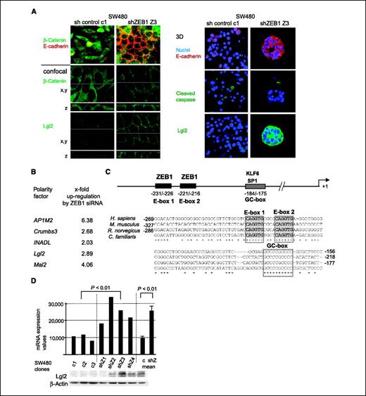 The Transcriptional Repressor ZEB1 Promotes Metastasis and Loss of Cell ...
