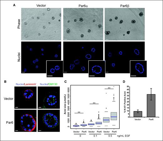 The Polarity Protein Par6 Induces Cell Proliferation and Is ...