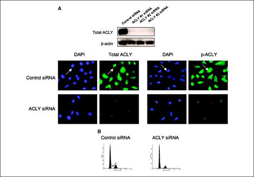 ATP Citrate Lyase: Activation and Therapeutic Implications in Non–Small ...