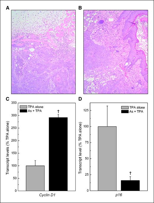Arsenic Exposure In utero Exacerbates Skin Cancer Response in Adulthood ...
