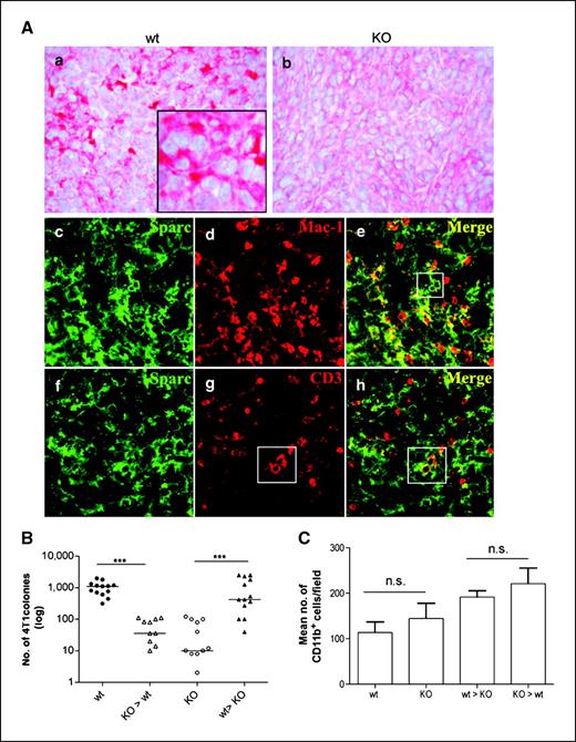 Macrophage-Derived SPARC Bridges Tumor Cell-Extracellular Matrix ...