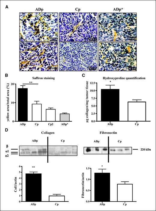 ADAMTS-1 Metalloproteinase Promotes Tumor Development through the ...