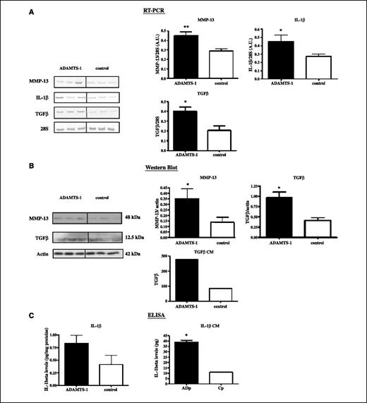 ADAMTS-1 Metalloproteinase Promotes Tumor Development through the ...