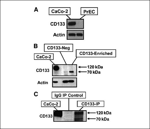 The Role of CD133 in Normal Human Prostate Stem Cells and Malignant ...