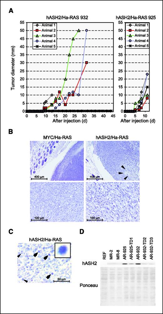 The Human Trithorax Protein hASH2 Functions as an Oncoprotein | Cancer ...