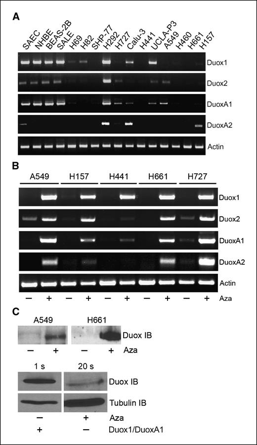 Silencing of DUOX NADPH Oxidases by Promoter Hypermethylation in Lung ...
