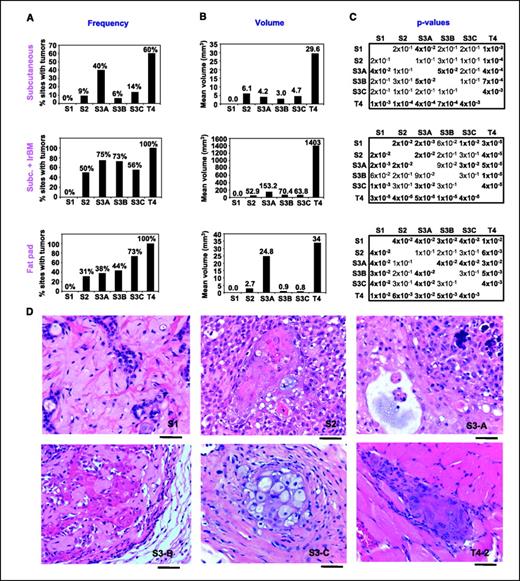 A Human Breast Cell Model of Preinvasive to Invasive Transition ...