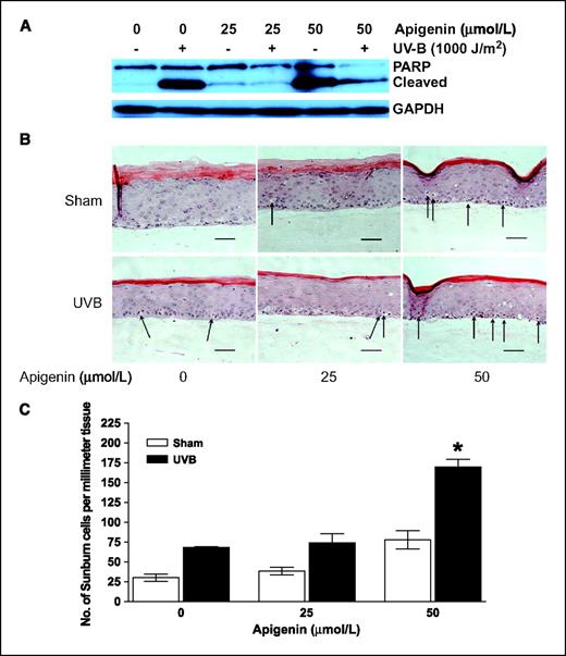 Enhancement of UVB-Induced Apoptosis by Apigenin in Human Keratinocytes ...