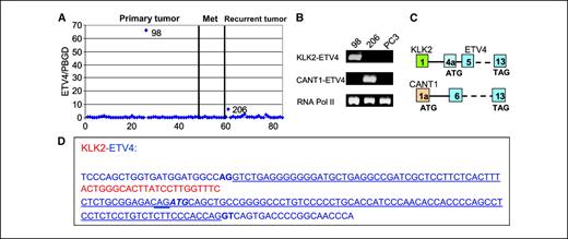 Two Unique Novel Prostate-Specific and Androgen-Regulated Fusion ...