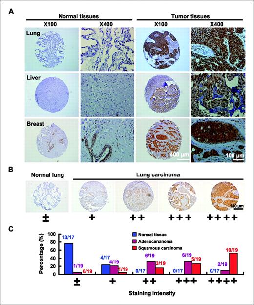 ROC1/RBX1 E3 Ubiquitin Ligase Silencing Suppresses Tumor Cell Growth ...