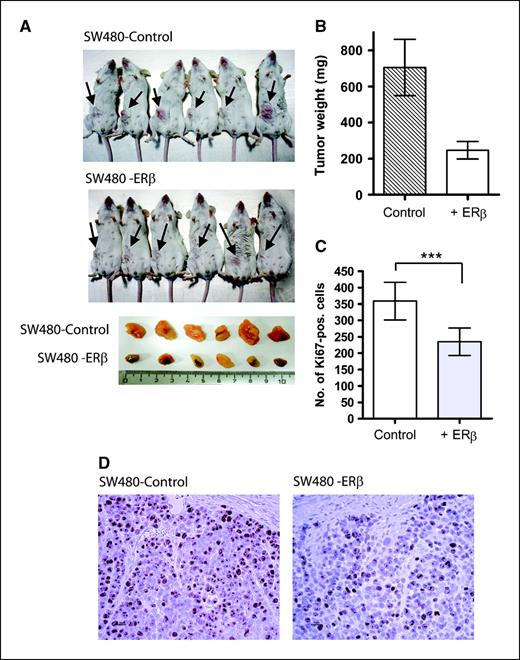 Tumor Repressive Functions of Estrogen Receptor β in SW480 Colon Cancer ...